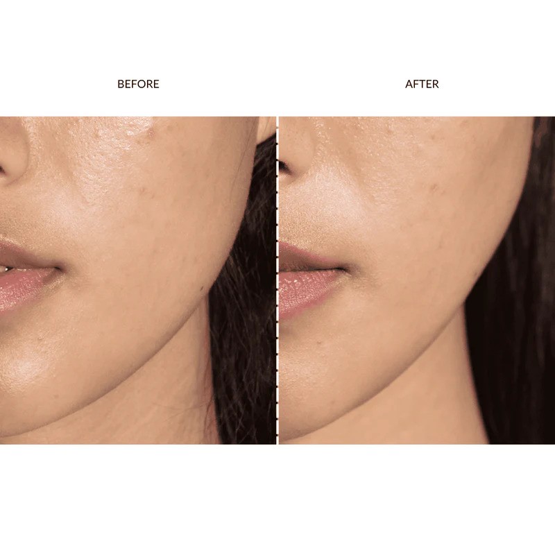 Foreo, FAQ 202 LED Mask