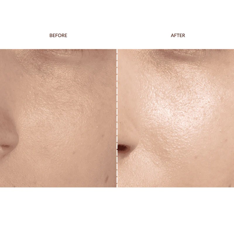 Foreo, FAQ 202 LED Mask