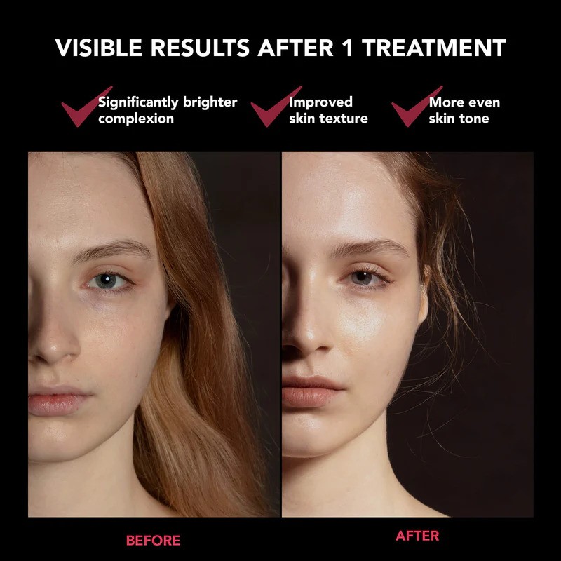 Foreo, FAQ 202 LED Mask